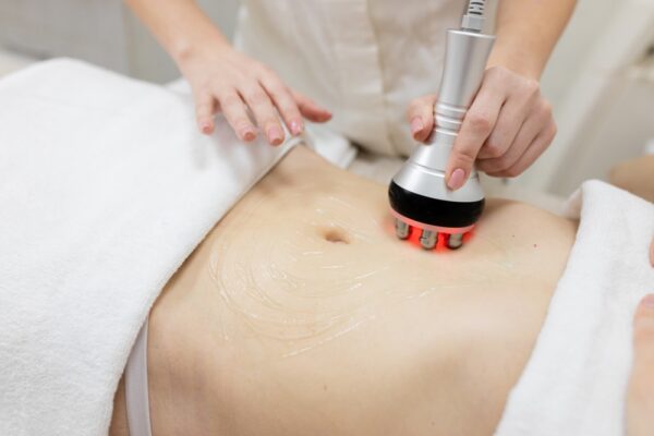 RF (Radiofrequency) Treatment | La Crown | Aesthetic Clinic
